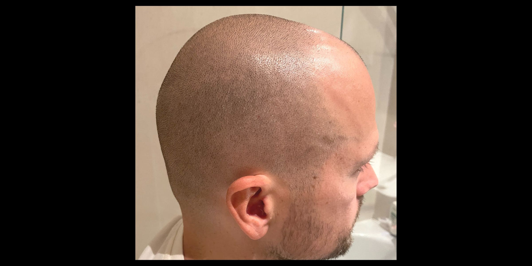 Bald Express Mens Head Shaver | The Bald Brothers | Bald Head Shaver ...