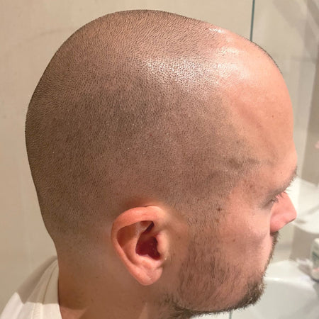 The Bald Brothers® Store | Ultimate Skincare Products For Bald People