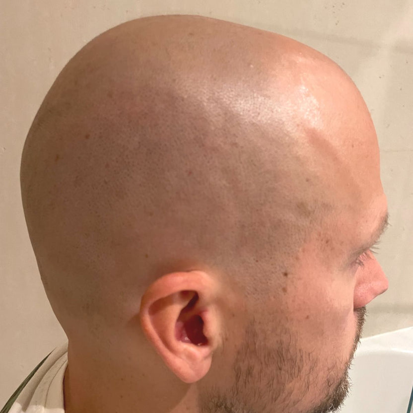 Clean Cut Bald Head Shaver Bundle For Men | Mens Electric Head Shaver ...