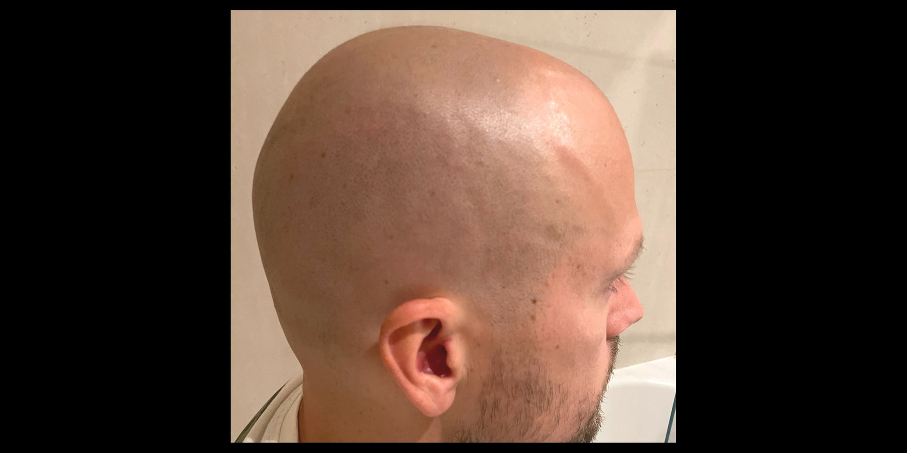 Bald Express Mens Head Shaver | The Bald Brothers | Bald Head Shaver ...