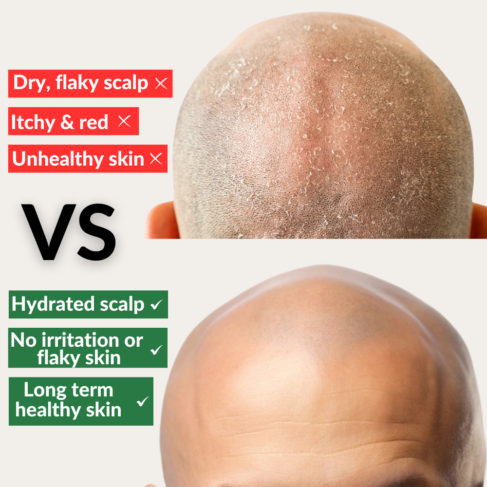 Mattifying Bald Head Moisturiser 90ml | Bald Head Matte Moisturiser For ...